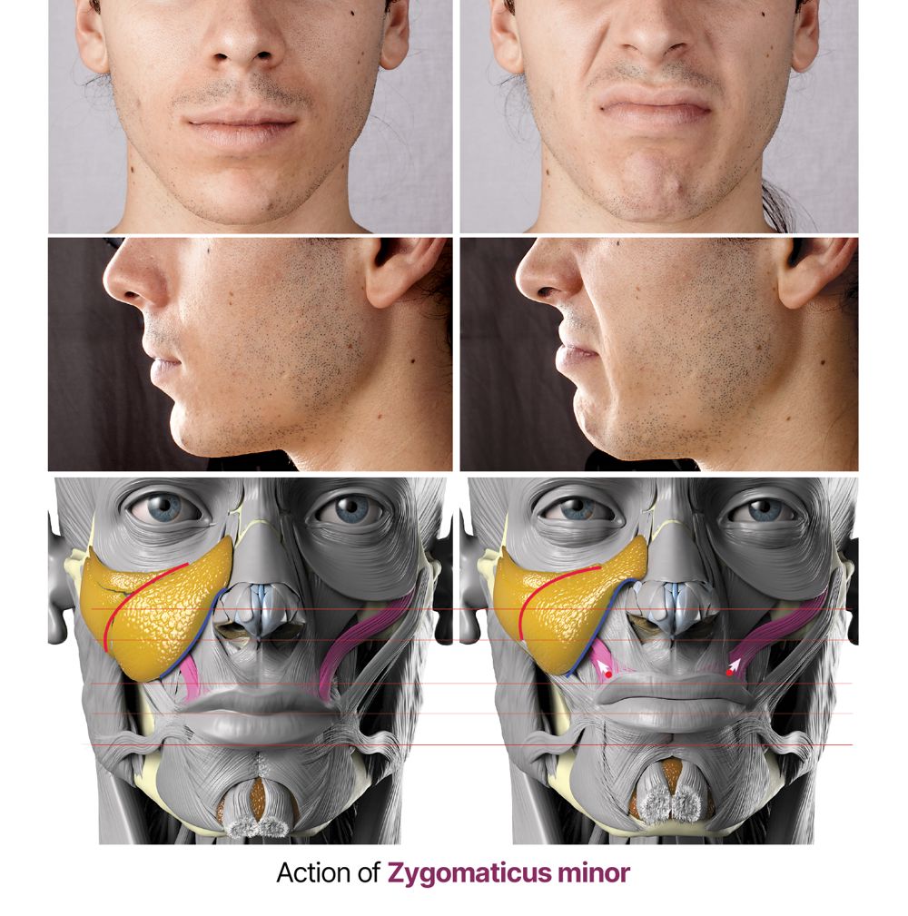 Action of Zygomaticus minor | Anatomy.app
