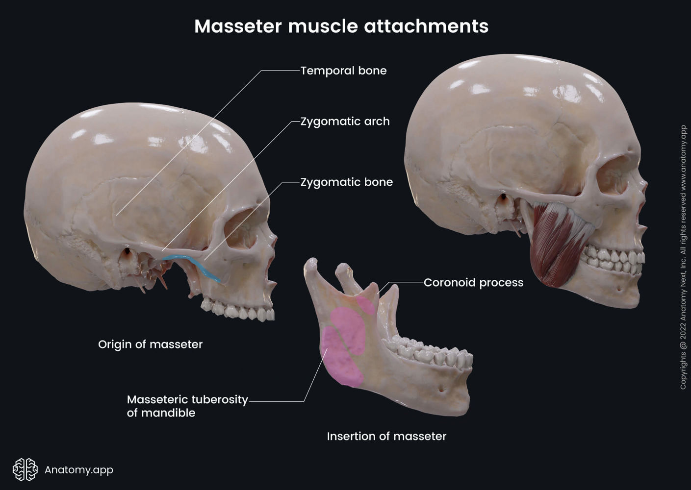 Origin and insertion of masseter | Anatomy.app