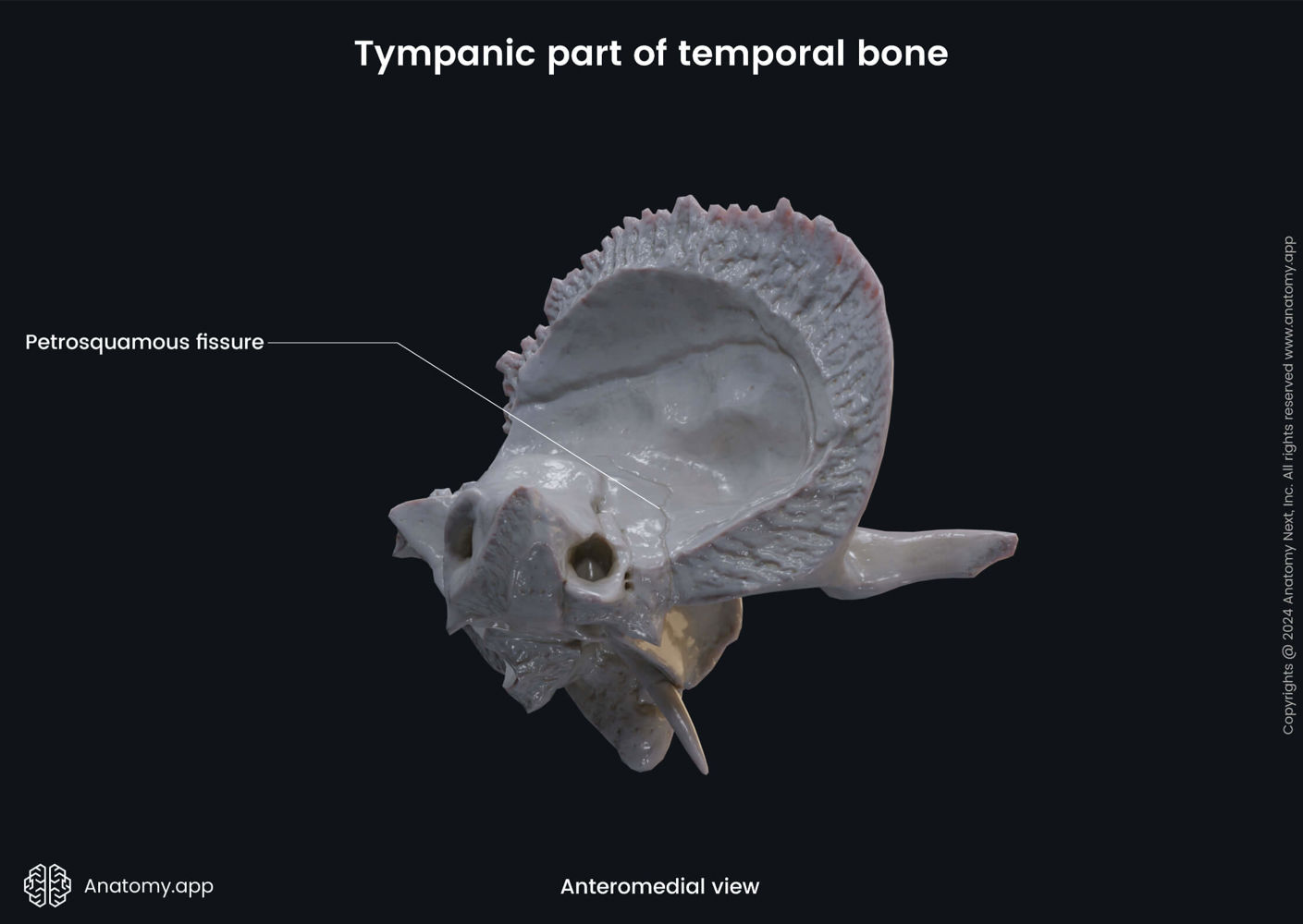 Tympanic part of temporal bone (anteromedial view) | Anatomy.app