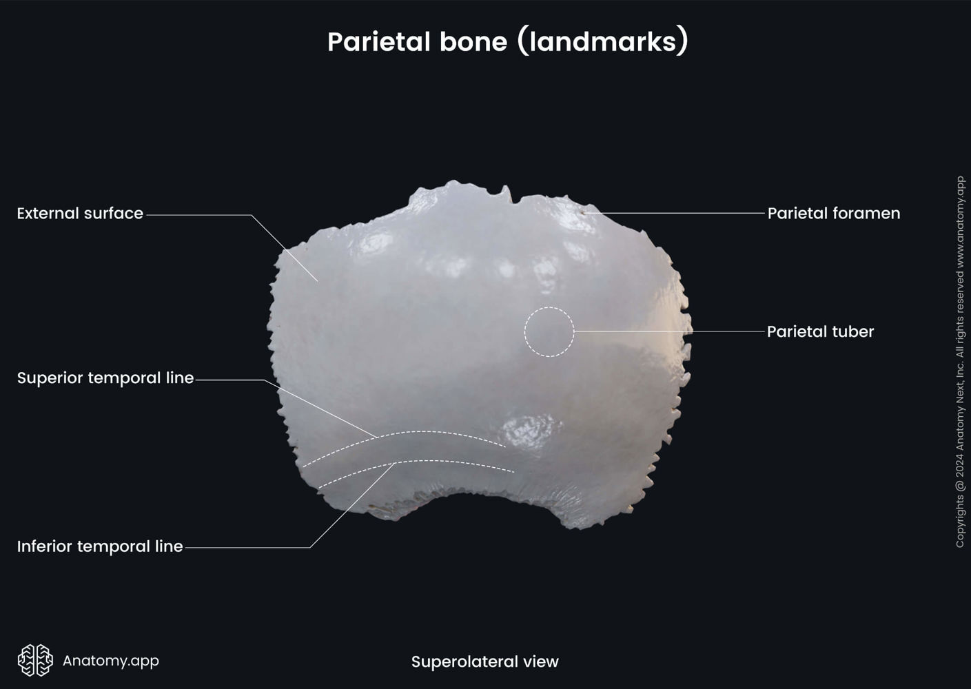 Landmarks of parietal bone (external surface) | Anatomy.app