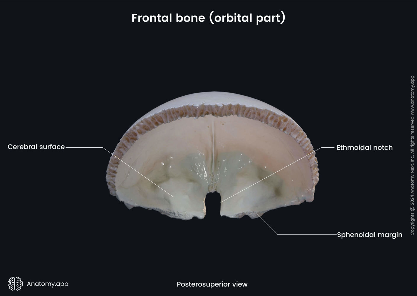 Landmarks of frontal bone (squamous part) | Anatomy.app