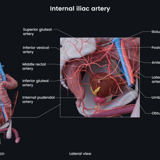 Overview of internal iliac artery | Anatomy.app