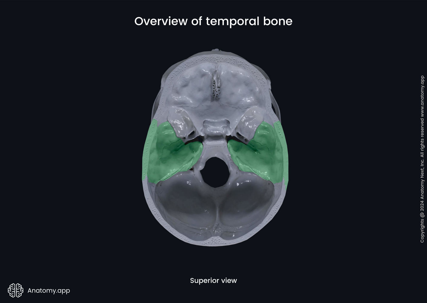 Overview of temporal bone (superior view) | Anatomy.app