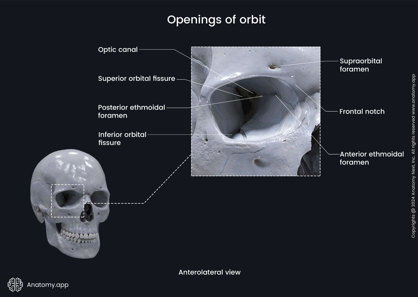 Openings of orbit (anterolateral view) | Anatomy.app