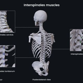 Biomechanics of the spine: lateral flexion (with the skull, thorax, and ...